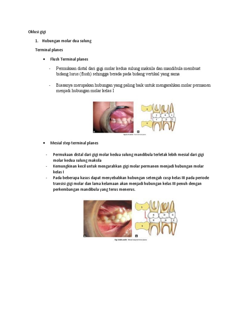 Oklusi Gigi | PDF