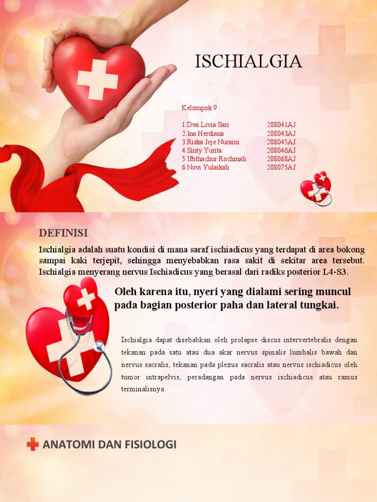 Ischialgia | PDF