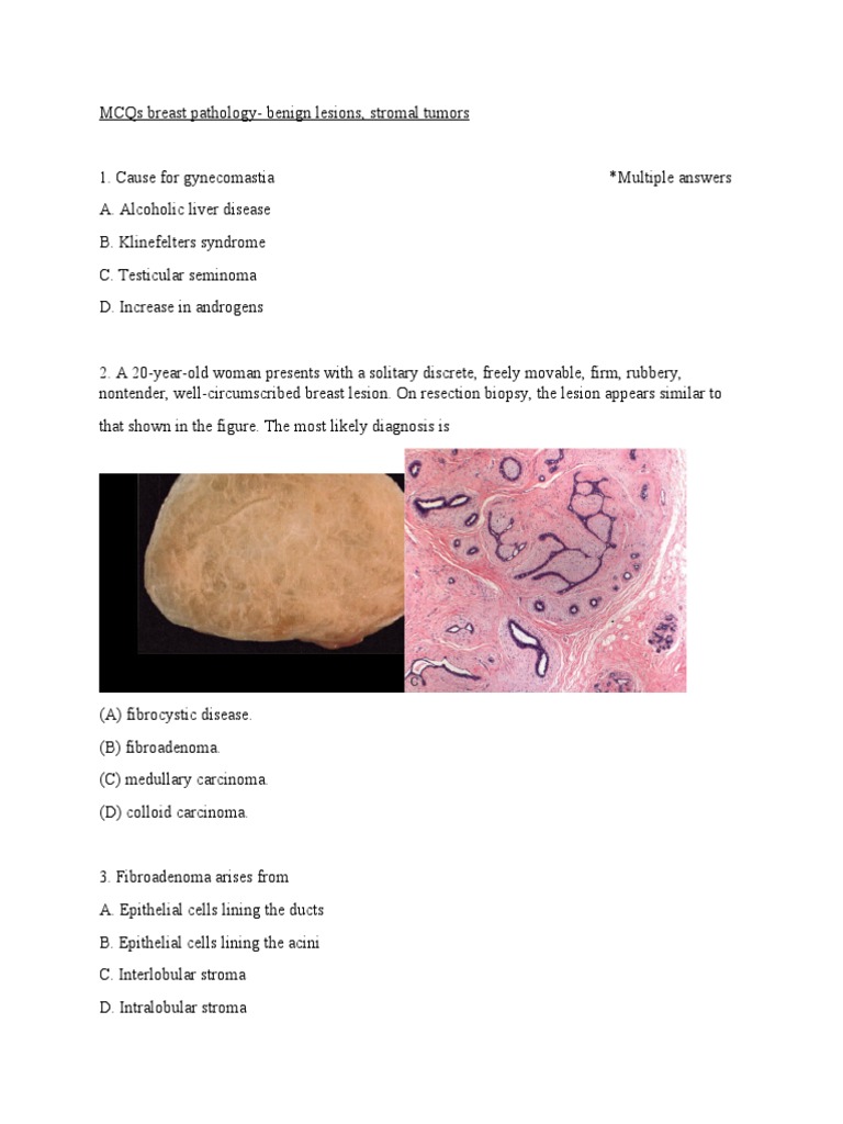 MCQs Breast Pathology 1 | PDF | Neoplasms | Medical Specialties