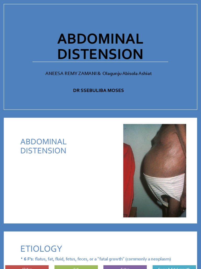 Abdominal Distension Guide | PDF | Cirrhosis | Diseases And Disorders