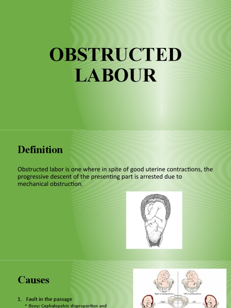 Obstructed Labour | PDF | Childbirth | Uterus