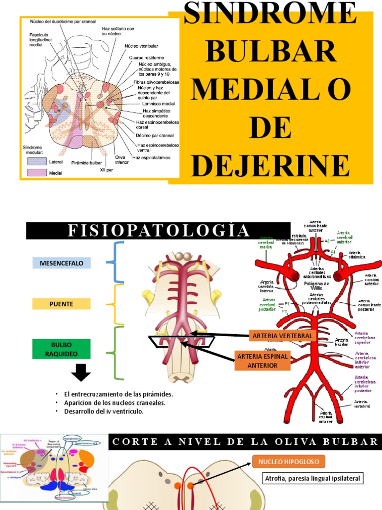 Sindrome Bulbar Medial o Anterior de Dejerineque | PDF
