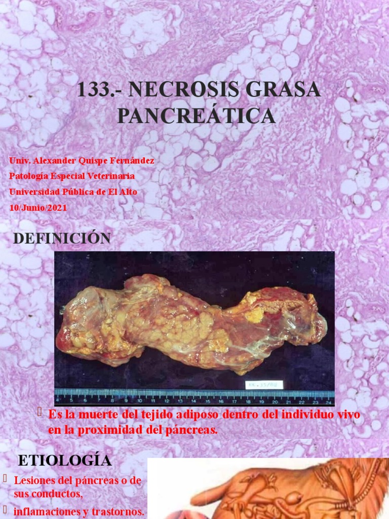 133 Necrosis Grasa Pancreática | PDF | Páncreas | Tejido adiposo