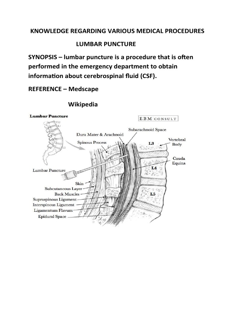 Lumbar Puncture | PDF | Cerebrospinal Fluid | Meningitis