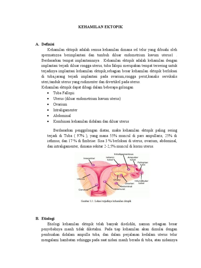 Kehamilan Ektopik | PDF | Sains & Matematika
