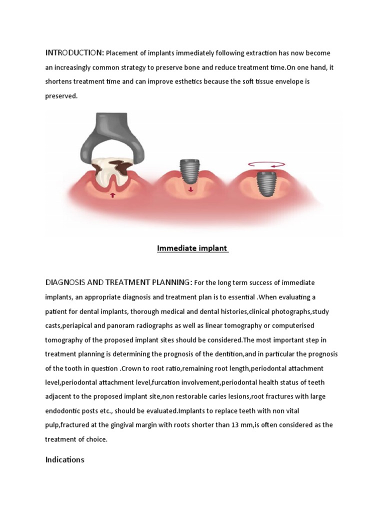 Implant Research | PDF | Dental Implant | Periodontology