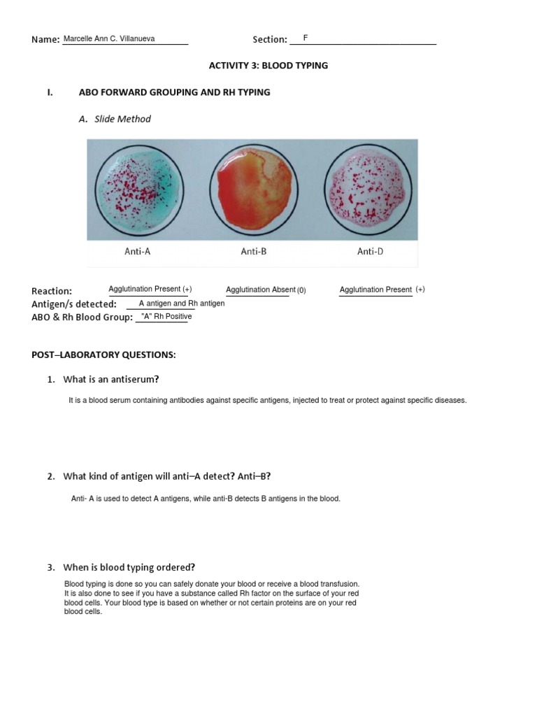 Activity 3 Blood Typing (Villanueva) | PDF | Wellness