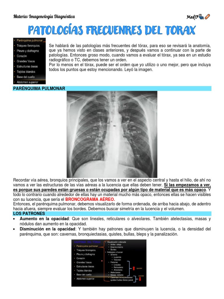 Patologías Frecuentes Del Tórax | PDF | Pulmón | Enfermedad pulmonar ...