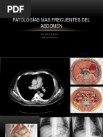 BACTICORT COMPLEX Crema VTA - J | PDF | Corticosteroides ...