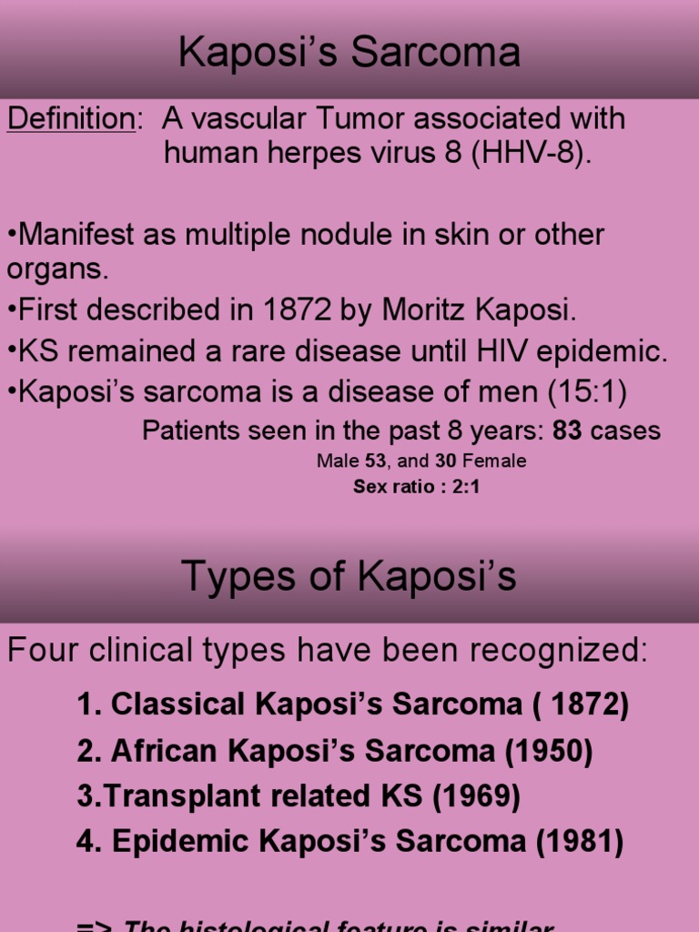 Kaposi's Sarcoma | PDF | Hiv/Aids | Neoplasms