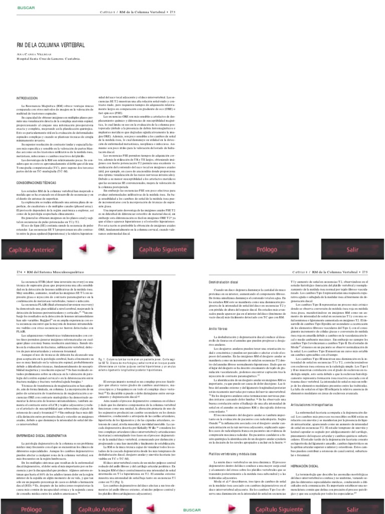 Interpretación de RM de Columna Lumbar | PDF | La columna vertebral ...