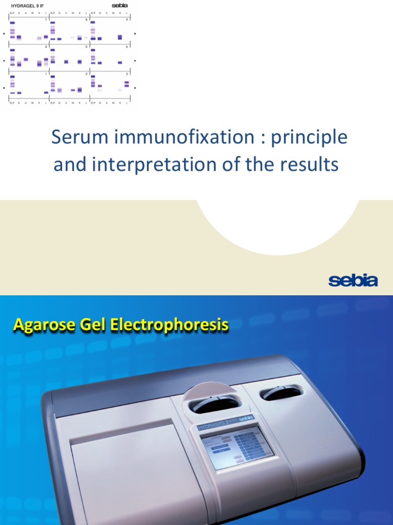 Serum Immunofixation Interpretation Guide | PDF | Antibody | Polyclonal ...