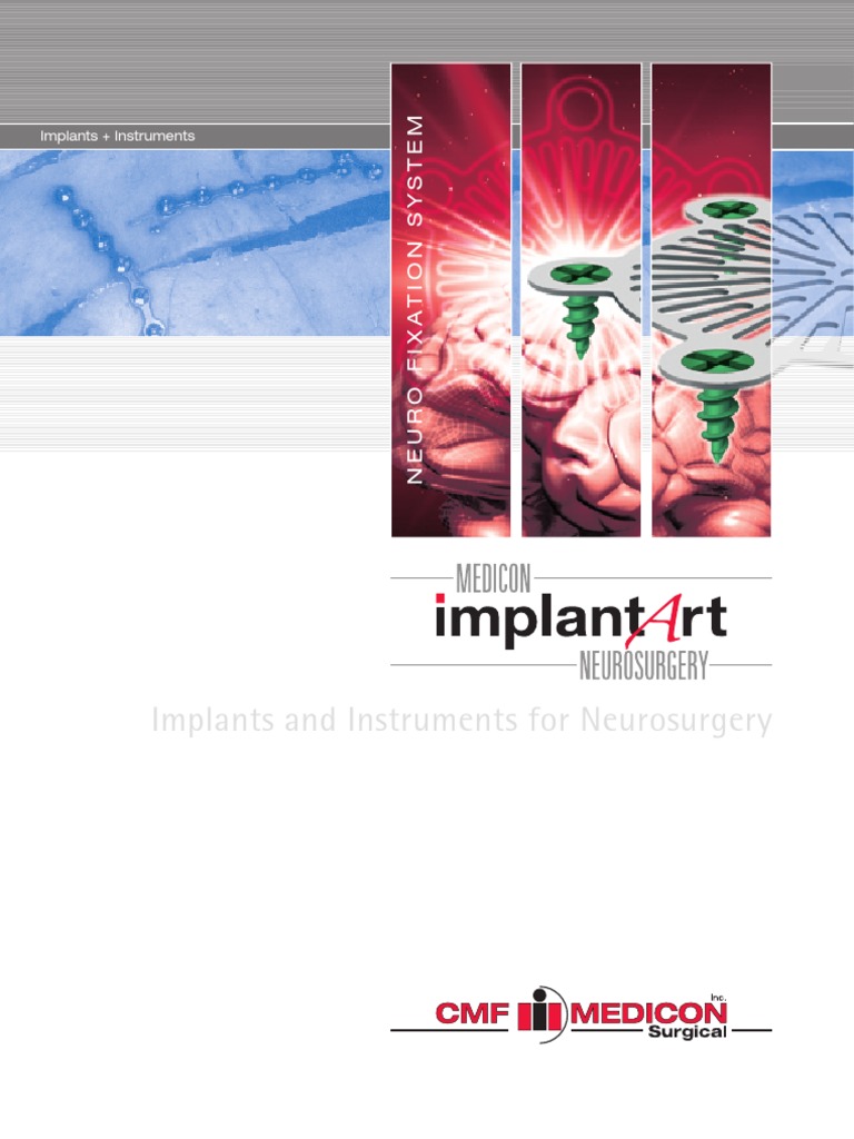 Brochure - Neuro Plating | PDF | Equipment | Manufactured Goods