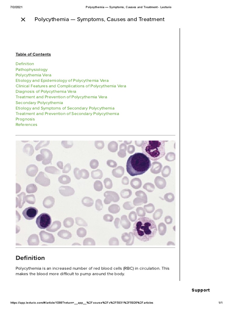 Polycythemia - Symptoms, Causes and Treatment - Lecturio | PDF