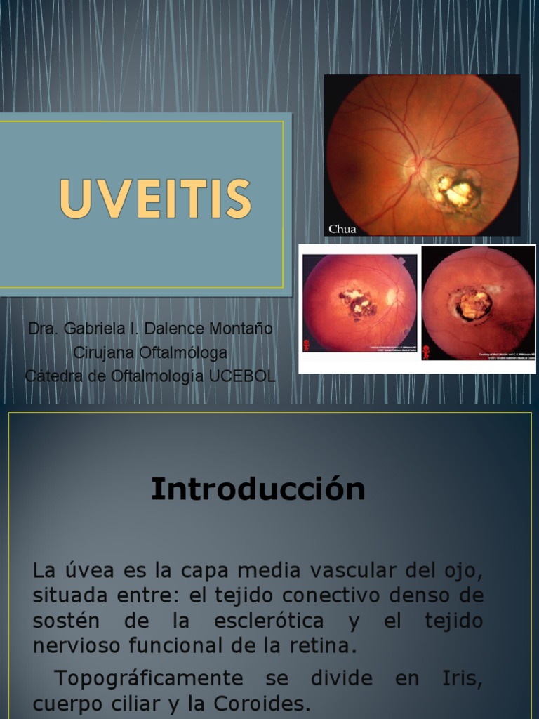 Uveítis: Causas, Síntomas y Tratamiento | PDF | Inflamación | Ojo humano