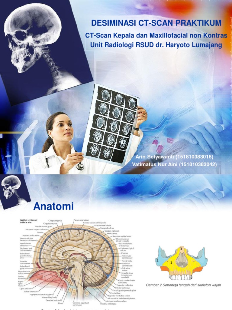 Desiminasi Ct-Scan Praktikum | PDF