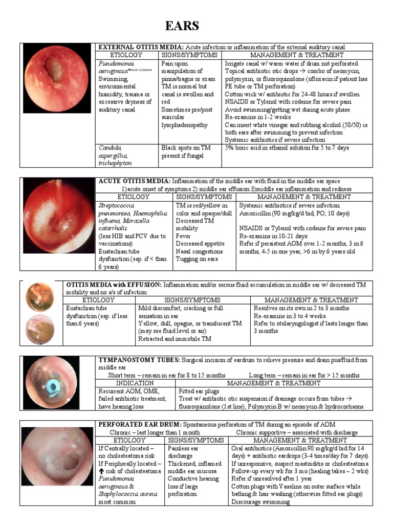 Ears - Boards | PDF | Otorhinolaryngology | Diseases And Disorders