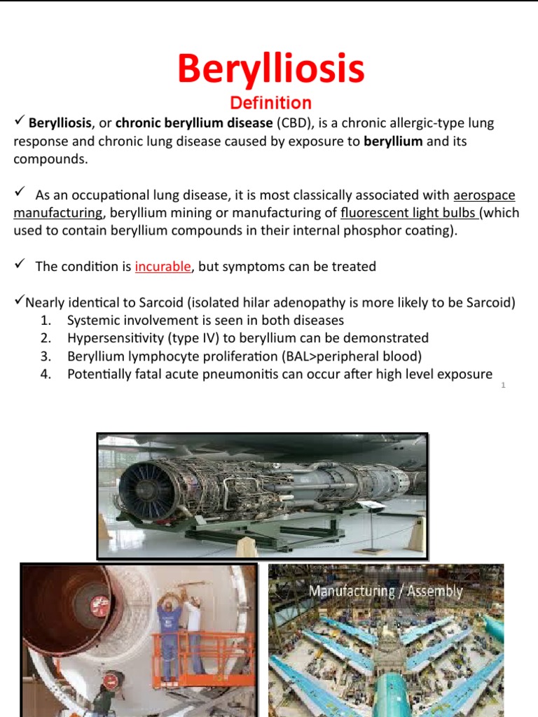 Berylliosis: Incurable | PDF | Epidemiology | Clinical Medicine