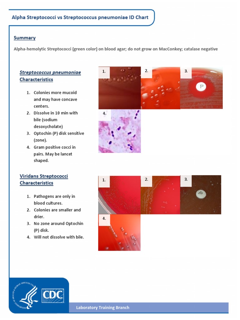 Differentiating Streptococcus pneumoniae from Viridans Streptococci ...