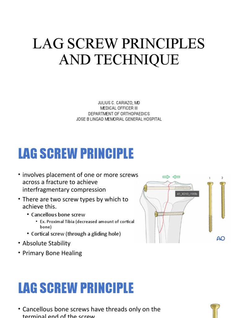 JBLMRH - Ortho - Lag Screw Technique | PDF | Drill | Screw