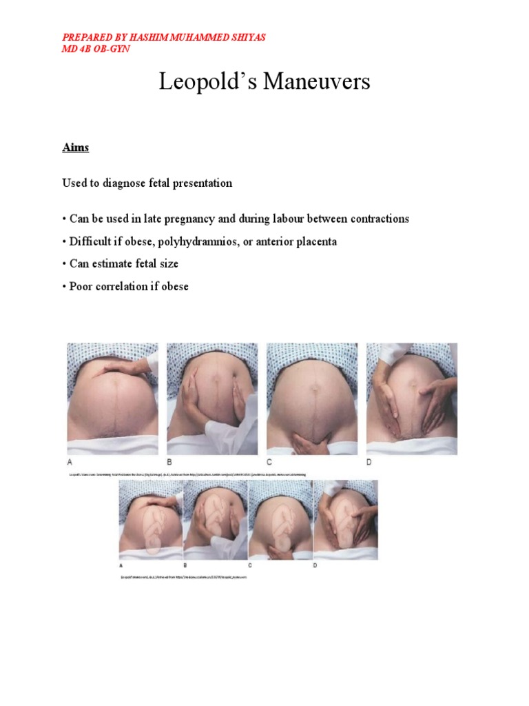 Leopold's Maneuvers: Prepared by Hashim Muhammed Shiyas MD 4B Ob-Gyn | PDF
