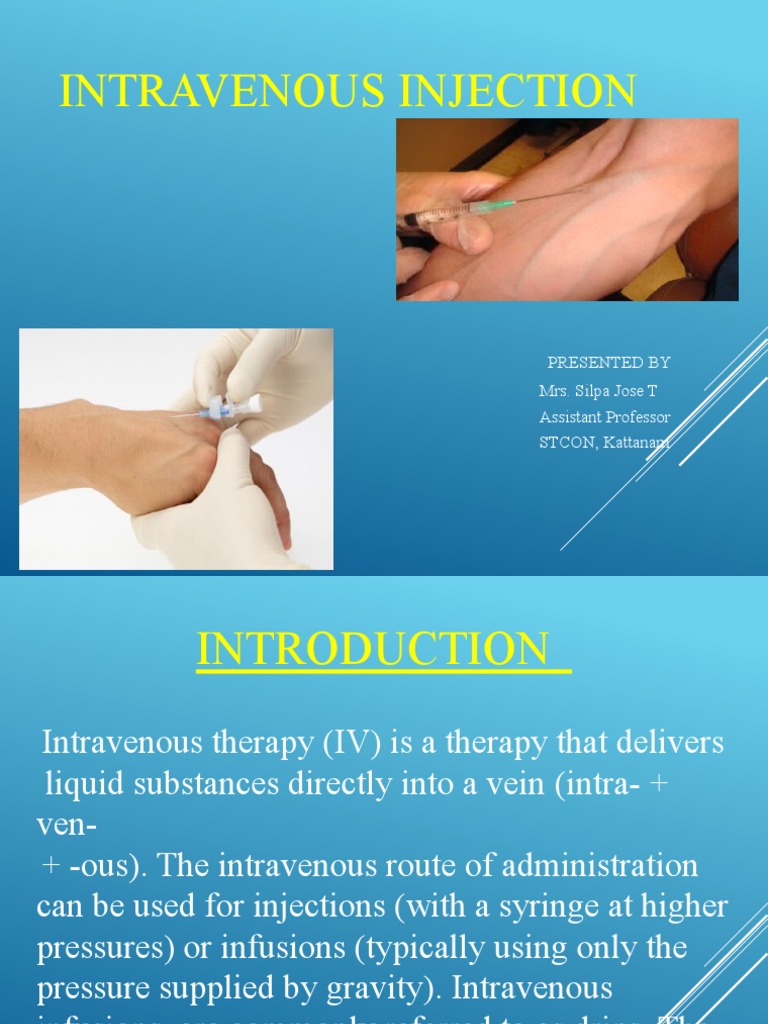 Intravenous Injection Sites