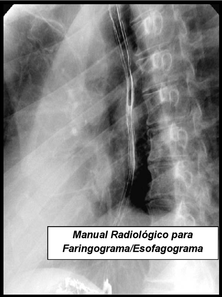 Manual de Faringograma y Esofagograma | PDF | Esófago | Nervio vago