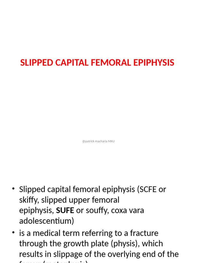 An Overview of Slipped Capital Femoral Epiphysis: Presentation ...