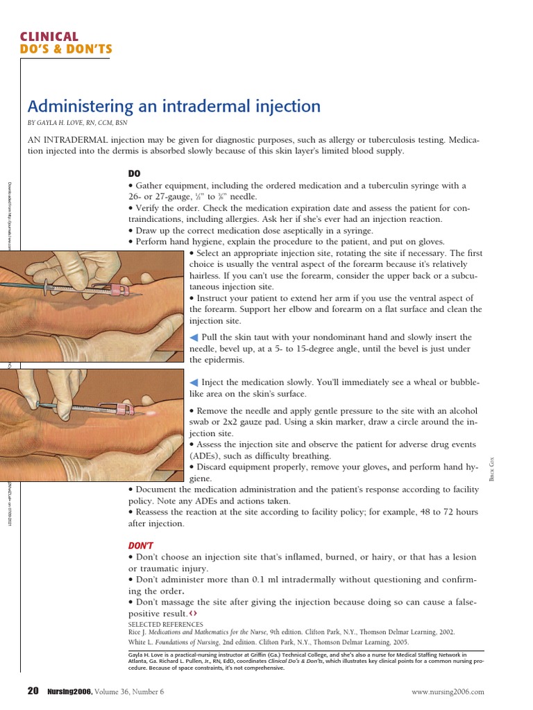 Intradermal Injection Guidelines for Nurses | PDF | Injection (Medicine ...