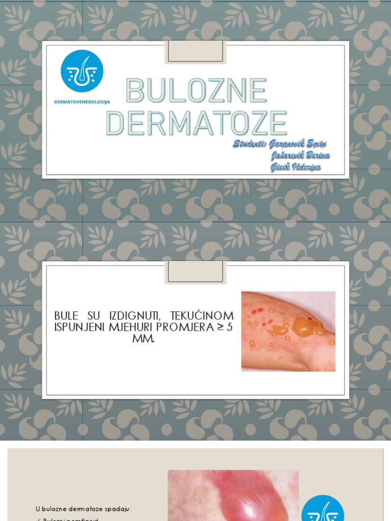 Bulozne Dermatoze | PDF