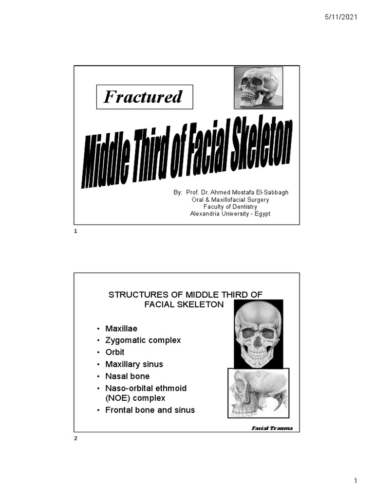 6 Middle Facial Fractures | PDF | Human Nose | Human Head And Neck