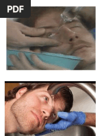 n82 - Procedure For Aural Toilet | PDF | Nursing | Patient