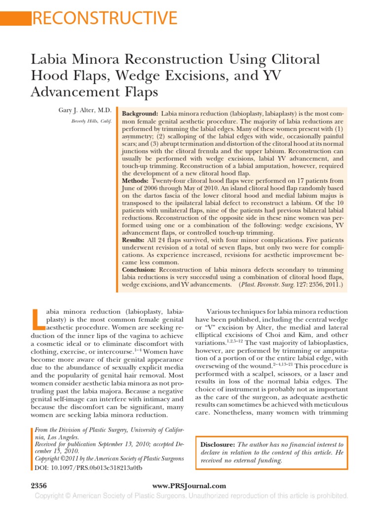Labia Minora Reconstruction Using Clitoral Hood Flaps, Wedge Excisions ...