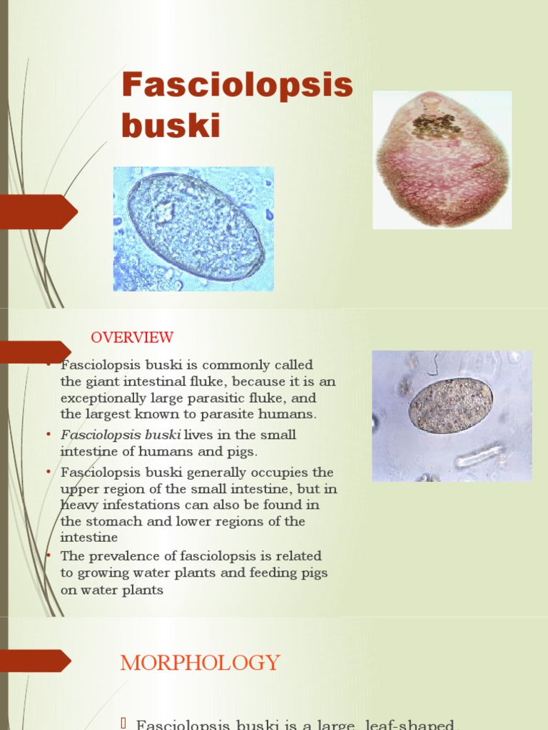 Fasciolopsis Buski Morphology