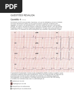 ECG - Eixo Eletrico Cardiaco 01 | PDF | Eletrocardiografia | Coração