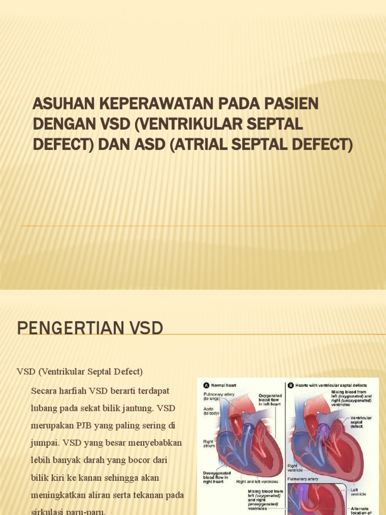 PPT Asd VSD | PDF
