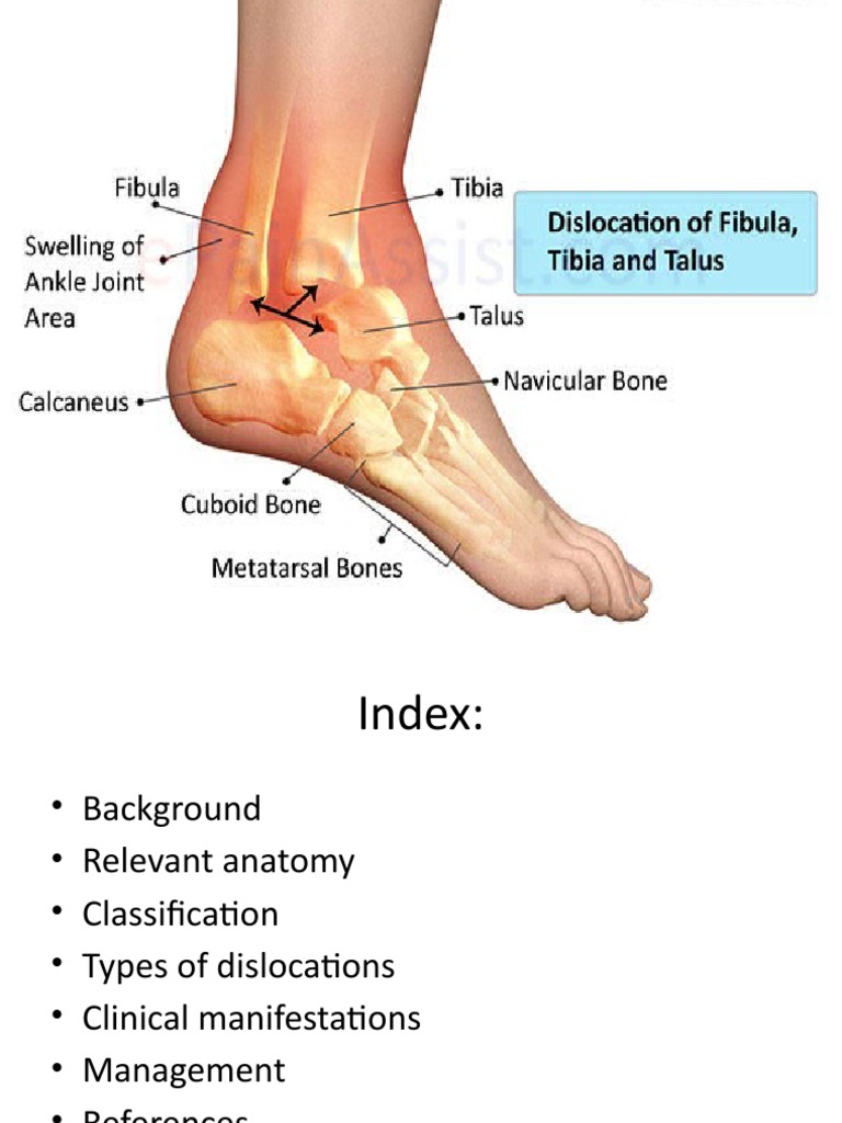 Ankle Dislocation | PDF | Ankle | Musculoskeletal Disorders