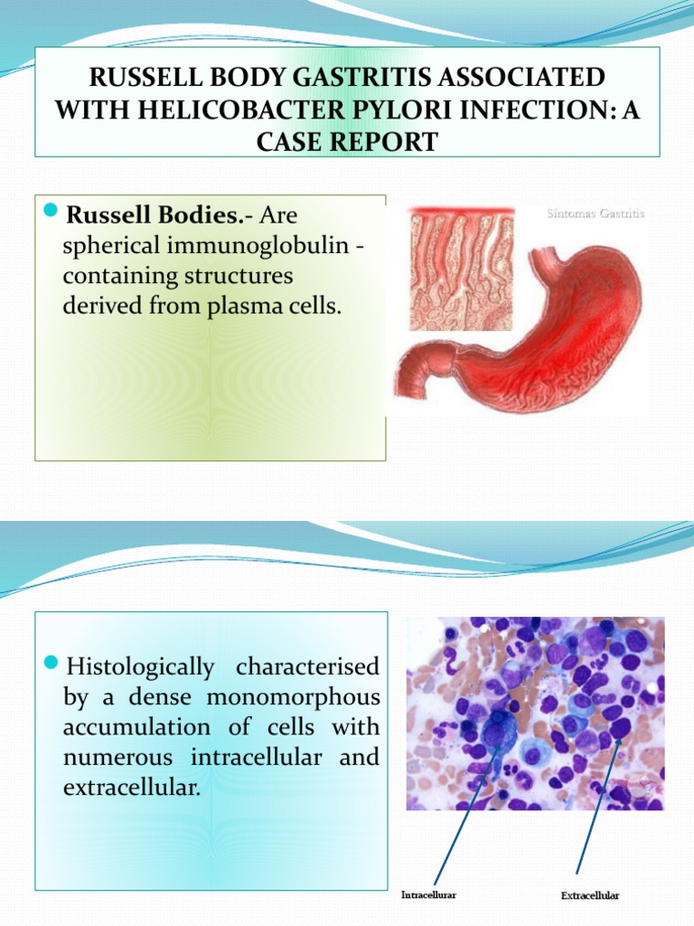 Russell Body Gastritis Associated With Helicobacter Pylori Infection: A ...