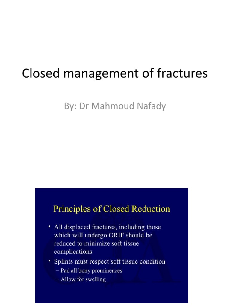 Closed Management of Fractures | PDF