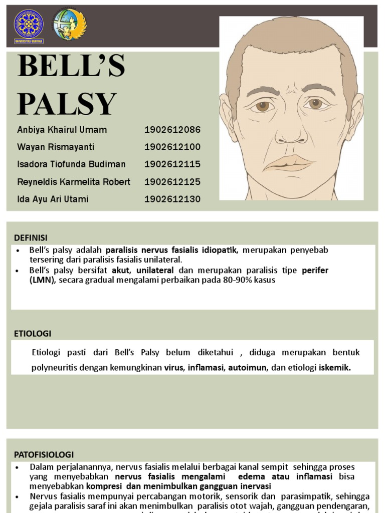 Bell's Palsy | PDF