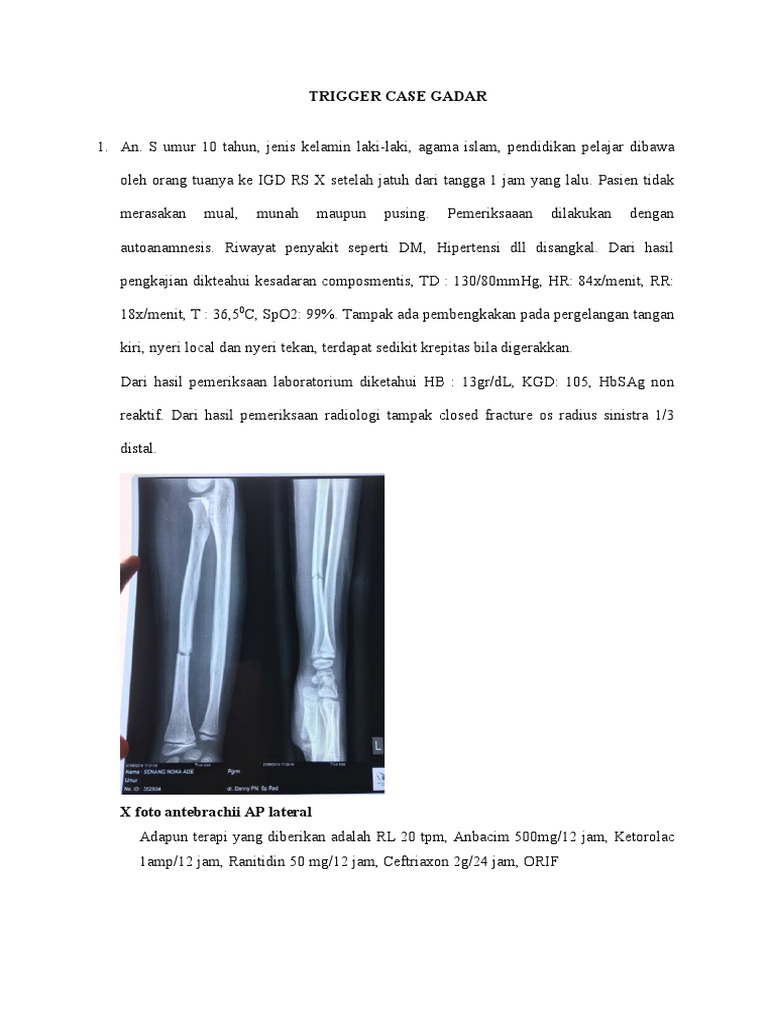 Trigger Case Gadar1 | PDF