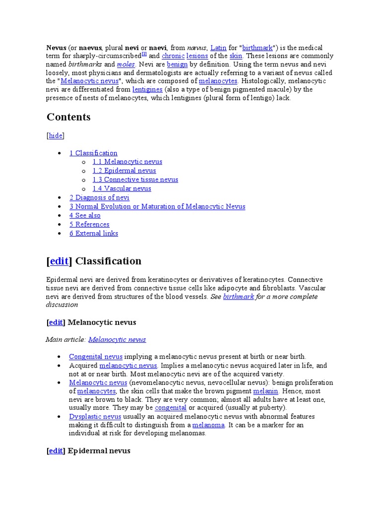 Moles: Nevus (Or Naevus, Plural Nevi or Naevi, From Nævus | PDF | Skin ...