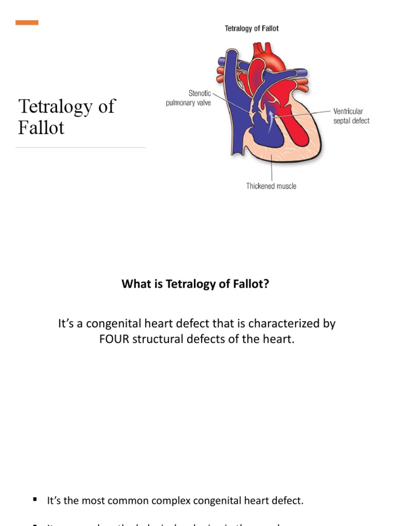 Tetralogy of Fallot | PDF | Congenital Heart Defect | Heart Valve