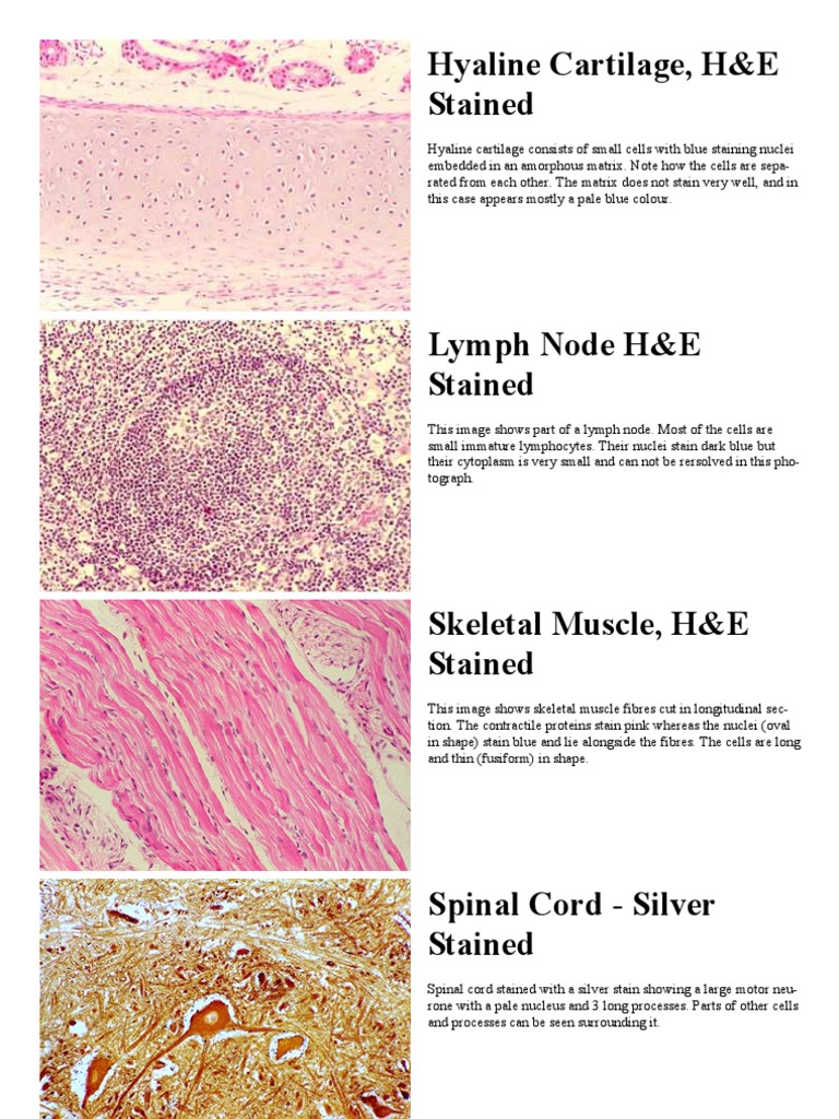 Histological Stains and Tissue Types | PDF | Epithelium | Lung