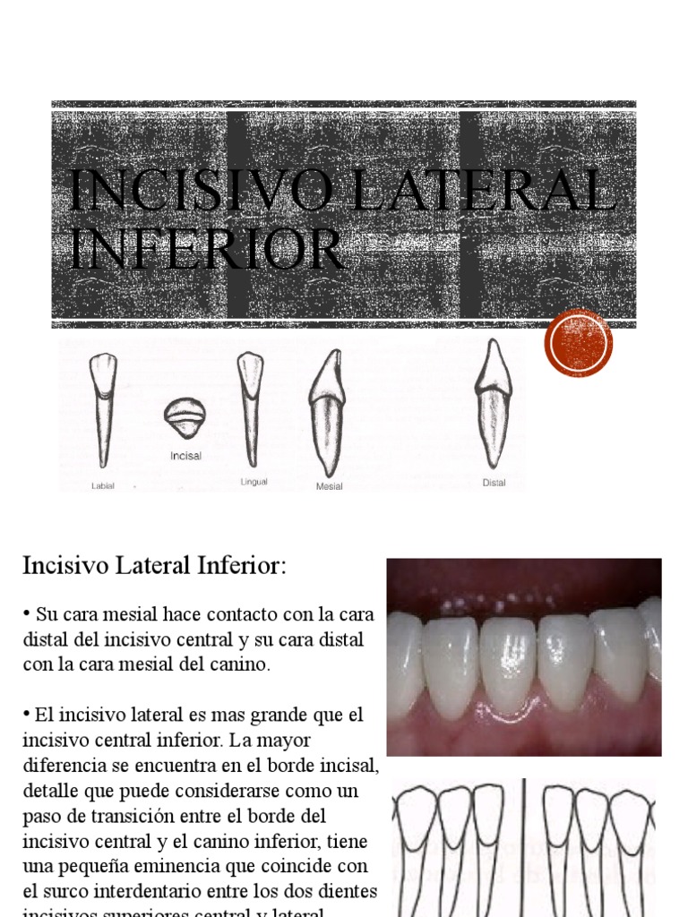 Incisivo Lateral Inferior | PDF | Anatomia dental | Diente