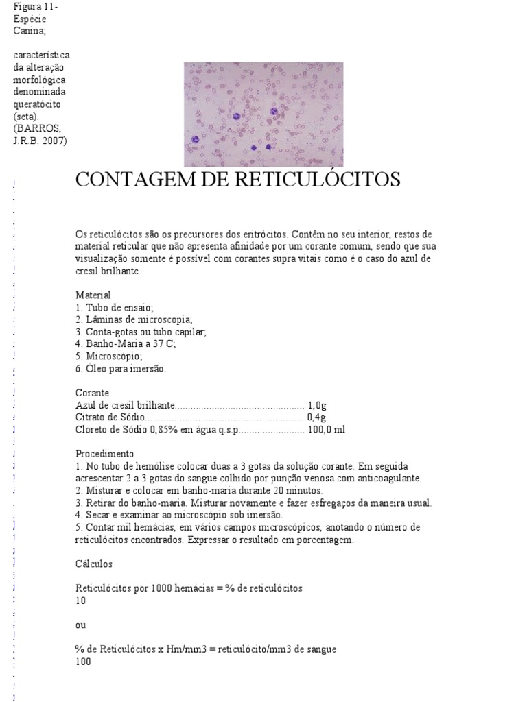 Contagem de Reticulócitos | PDF | Hematologia | Sangue