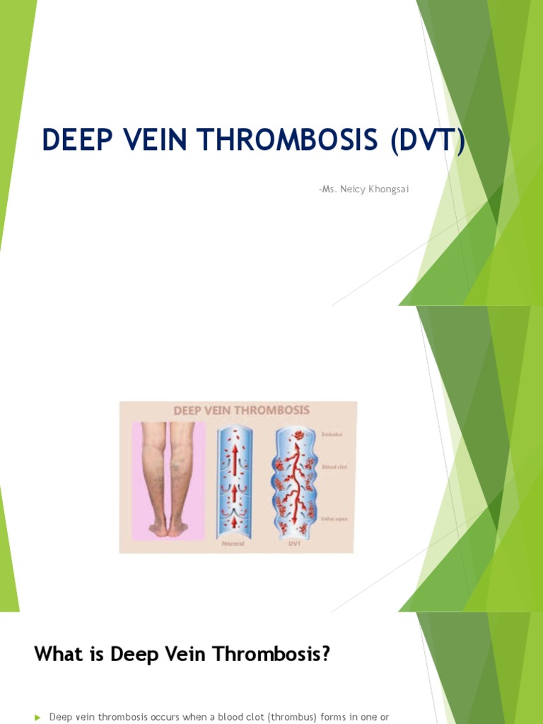 (Template) DVT | PDF | Thrombosis | Thrombus