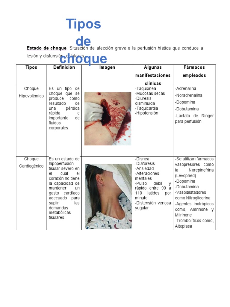 Tipos de Choque: Causas y Tratamientos | PDF | Septicemia | Medicina