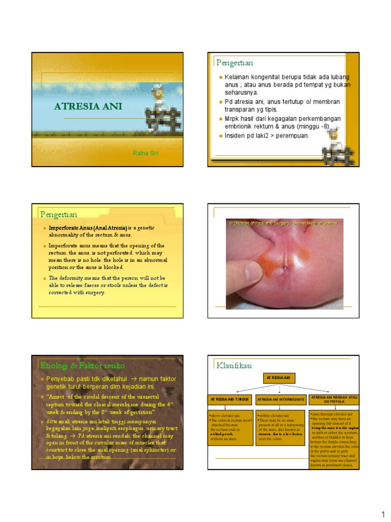 Atresia Ani Atresia Ani Pengertian Pdf Rectum Pelvis