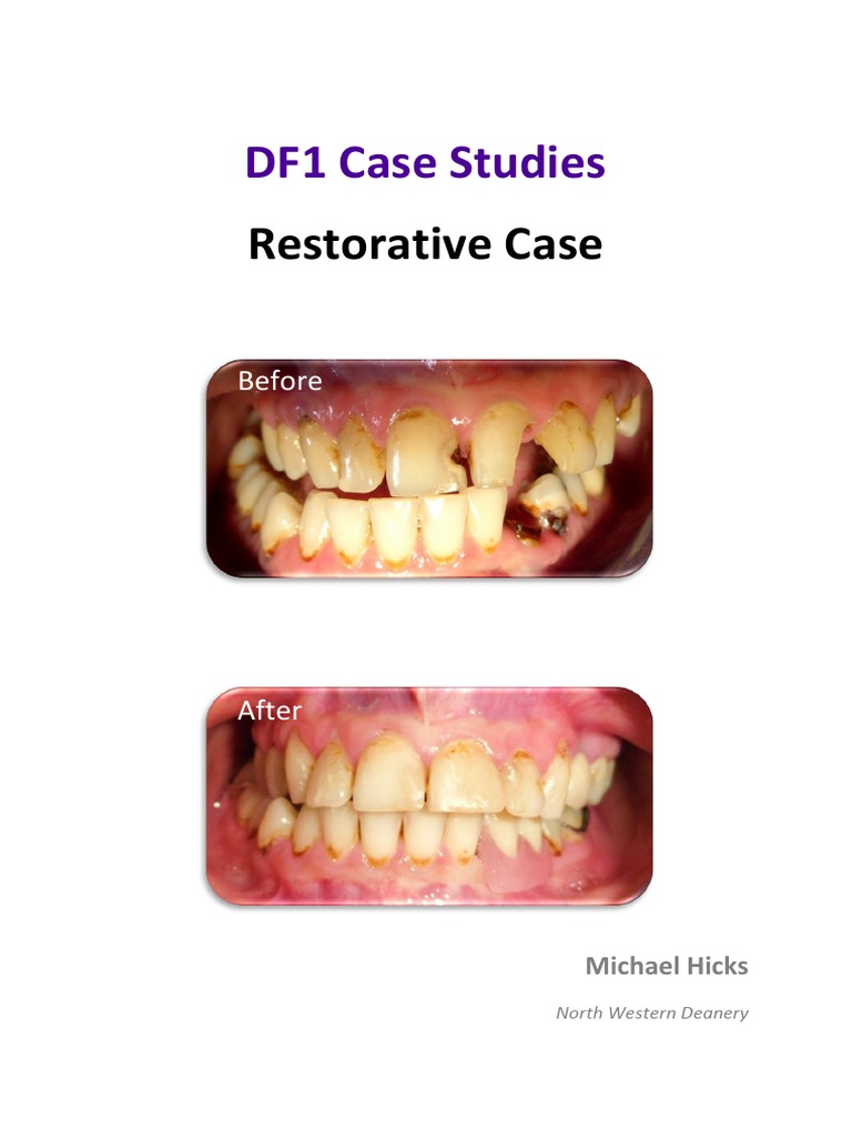 Restorative Case Write Up | PDF | Periodontology | Oral Hygiene